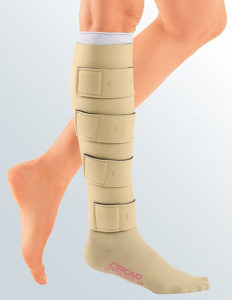 Adjustable Compression Device (ACD)